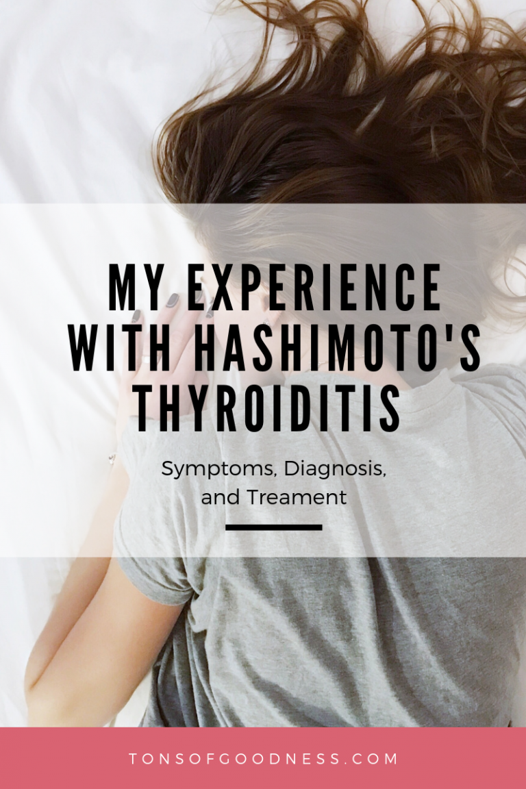 My Experience with Hashimoto's Symptoms, Diagnosis, and Treatment